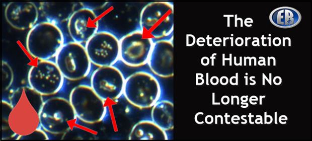 The Deterioration of Our Blood - Europe Reloaded